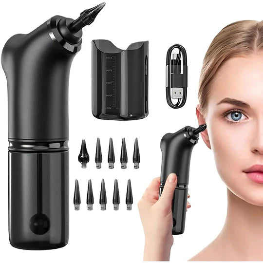 Water Ear Cleaner – Portable Electric Irrigation Kit for Safe Ear-Wax ...